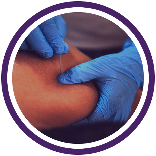 Trigger Point Dry Needling Englewood Co Reduce Muscle Tension